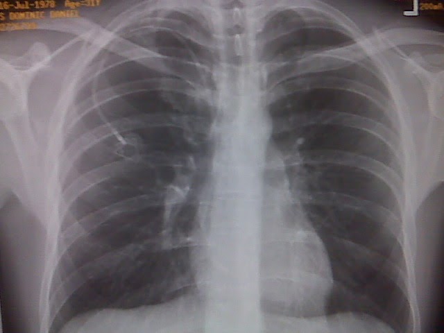 stahnooz: PowerPort Day!