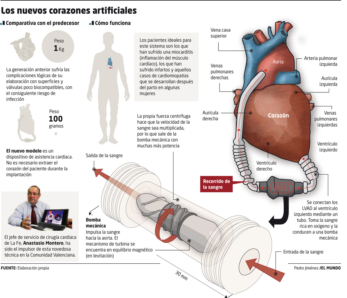 MIRA COMO SE HACE: Los nuevos corazones artificiales (JARVIK 7)