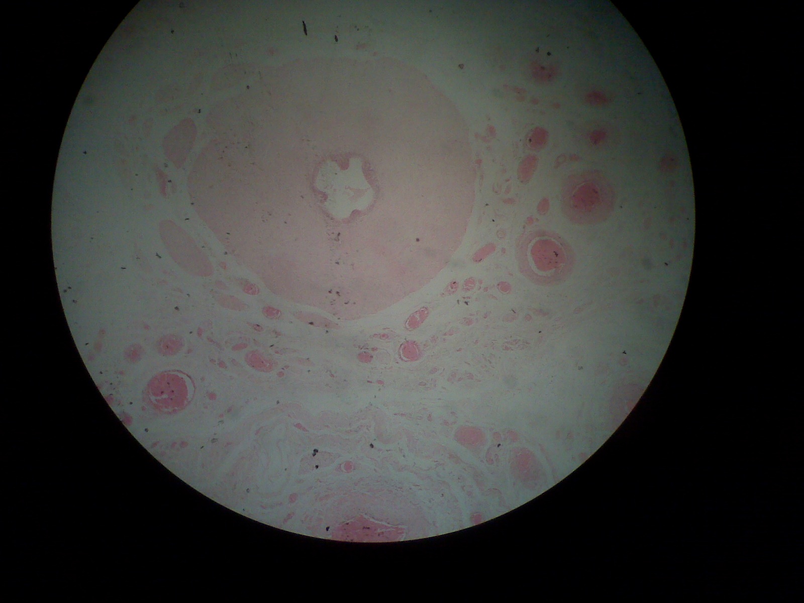 Psc Anatomy And Physiology 2 Spermatic Cord