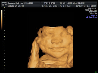 The Beddard Crew: 30 Weeks and 4D Ultrasound