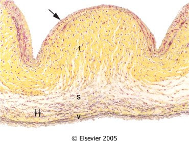 Histology for Dummies - Histología para Tontos: Válvulas Cardiacas