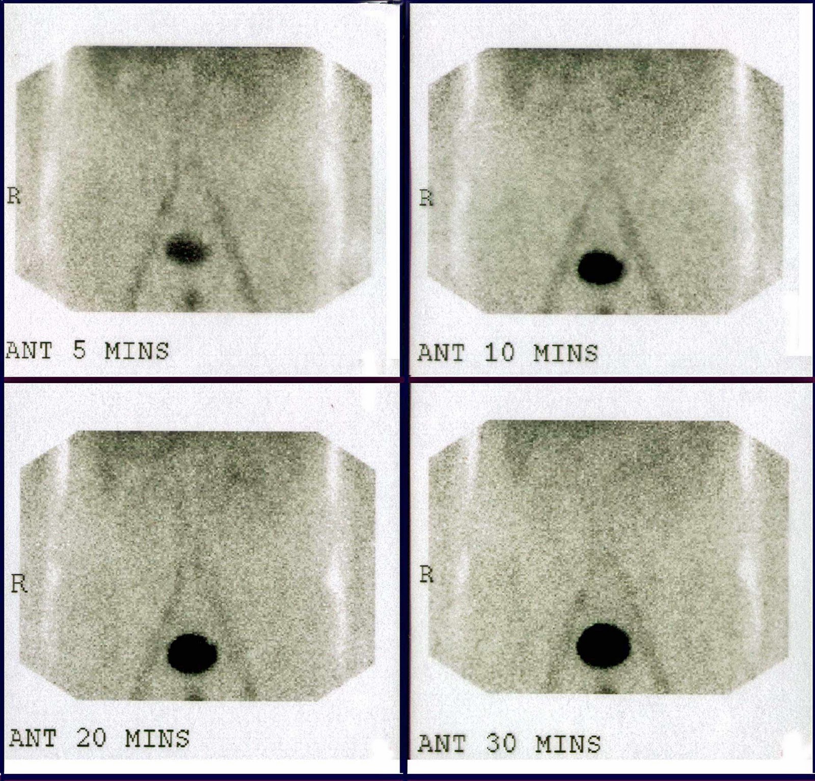 PSNM CASE DISCUSSIONS: CASE OF THE WEEK: SUMMARY & RESULTS
