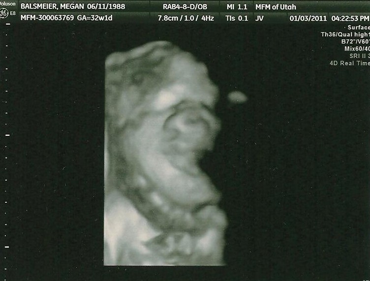 Megan, Larry, Allen, & Hayden Balsmeier: 32 Week Ultrasound!