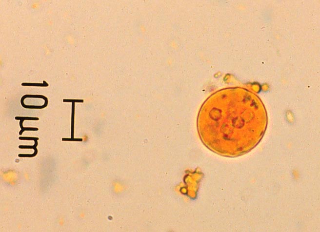 medicine: Entamoeba Coli