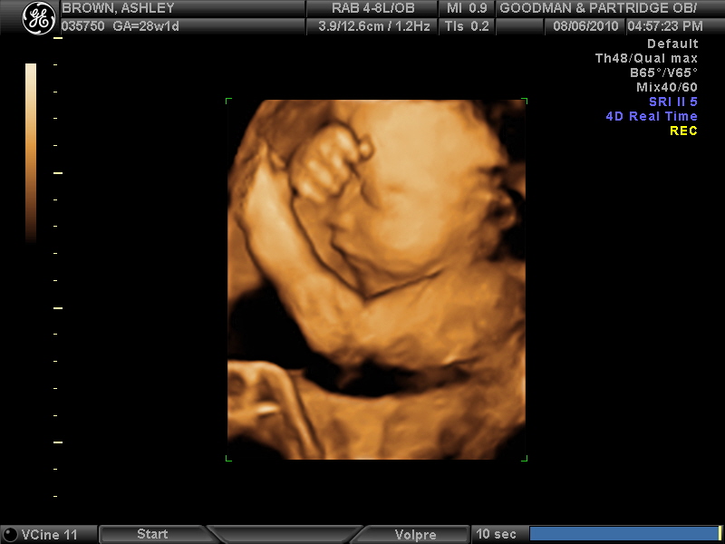 Life in the Brown House: 7 Month Mark (28 weeks)....Ultrasound and Amemia!