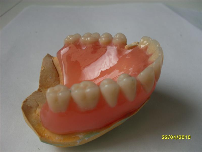 PROTESIS FLEXIBLES DEFLEX