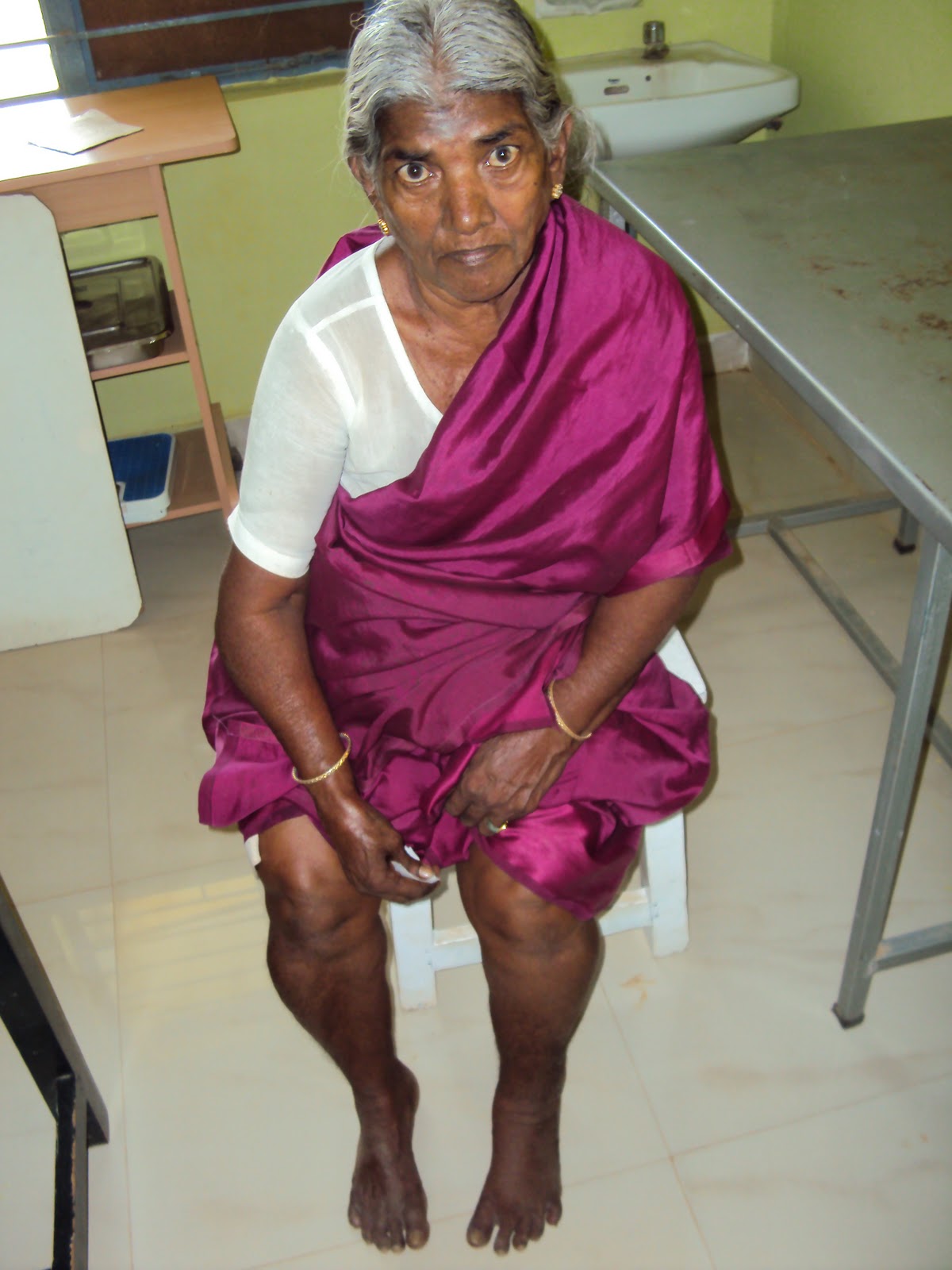 VARIYANKAVAL PHC: filarial morbidity management part 1 survey