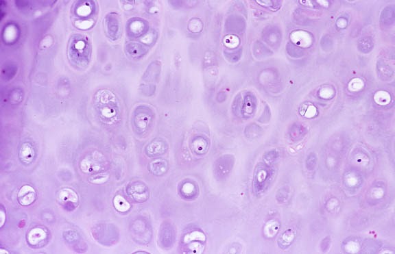 Histology Slides: Hyaline Cartilage