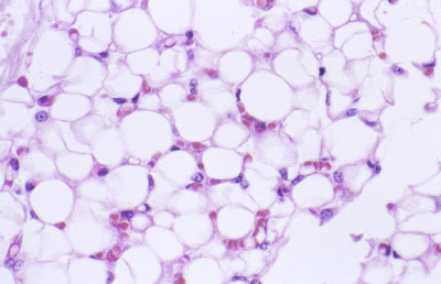 Histology Slides: Adipose Tissue (Fat)