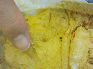 Rotavirus Diarrhea Color