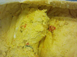 Kami-Ube Pediatric Clinic: White color stool in rotavirus infection