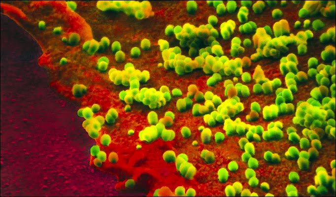 Perbedaan Virus Dengan Sel Hidup | BIOLOGIPEDIA