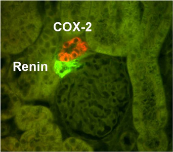Enzim Renin | BIOLOGIPEDIA