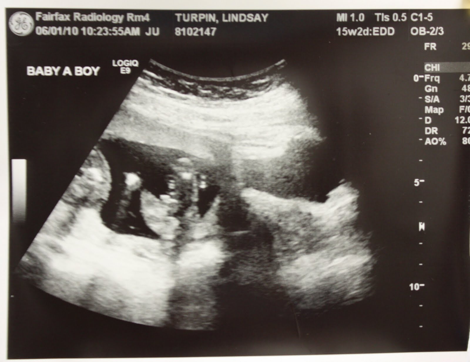 Adventures in Baby Making: 16 Weeks Ultrasound Pics