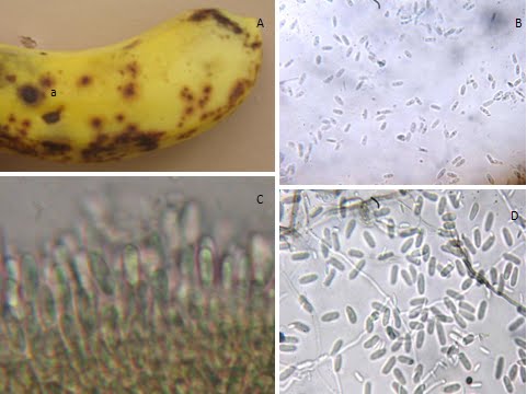 ESTUDOS EM DOENÇAS DE PLANTAS - IFGoiano - Campus Urutaí: Antracnose ...