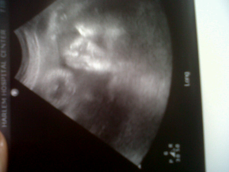 Harlem Lovebirds: 38 Weeks Ultrasound & Harlem Hospital