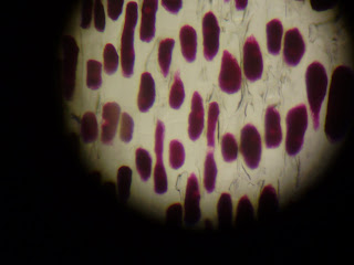 LabBio Escola: PLASMÓLISE