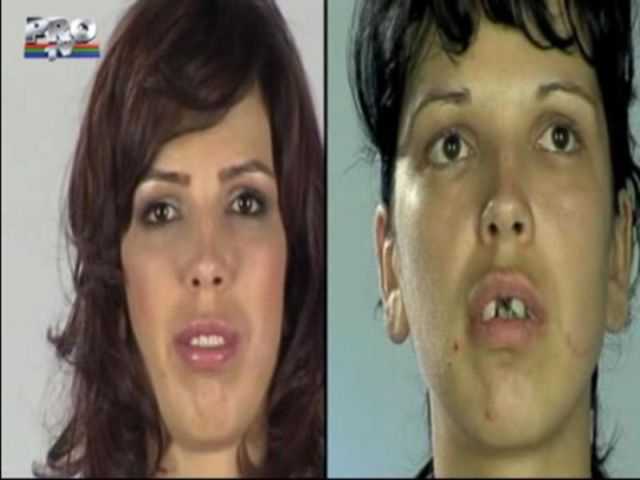 Amazing Miracle and Succesful Plastic Surgery ~ Unusual Things