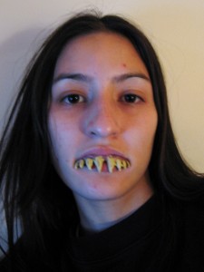 Craziest People with the Worst Teeth in the World ~ CRAZY PICS