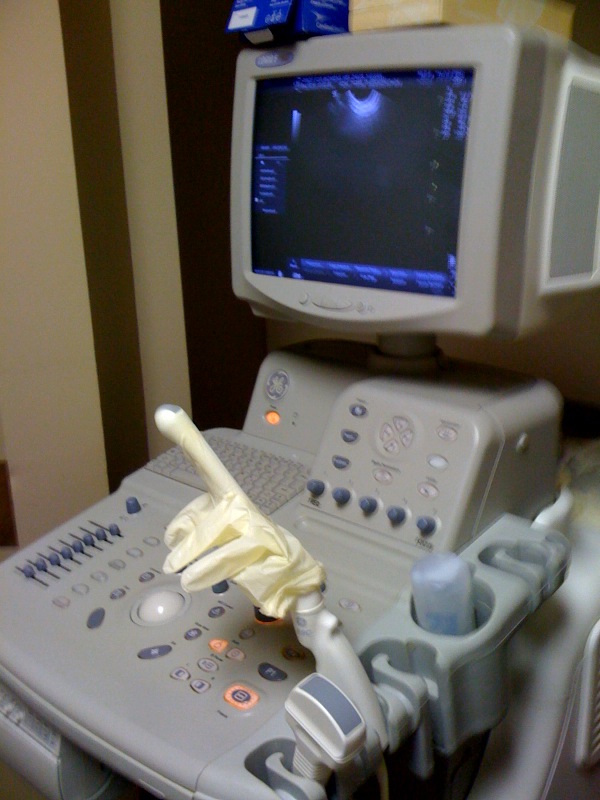 Life Beneath The Willow Trees: First Ultrasound