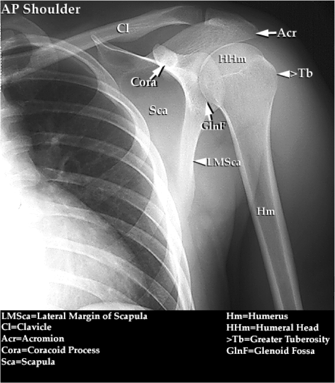 Physio Questions: Introduction to the Shoulder Complex (Part I) - What ...