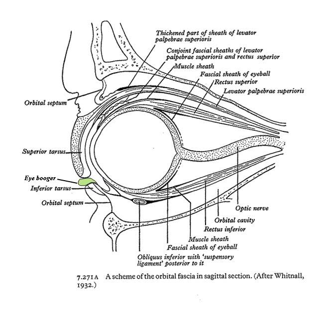 Too Far From Town to Learn Baseball: Eye Boogers