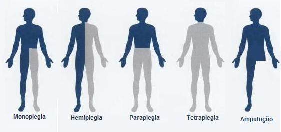 Igualdade na Diferença : Introdução à Deficiência Motora