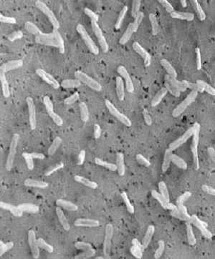microbiology: Corynebacterium diphtheriae