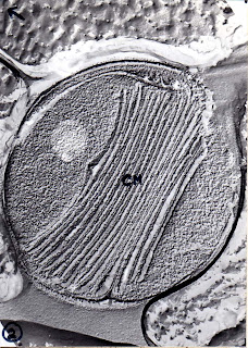 Tony's thoughts on the Natural World: 13b. Bacteria and other ...