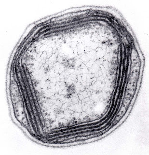 Tony's thoughts on the Natural World: 13b. Bacteria and other ...
