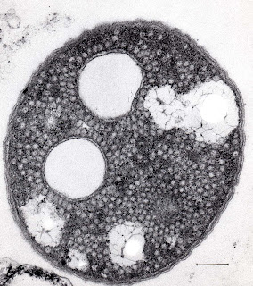 Tony's thoughts on the Natural World: 13c. Bacteria and other ...