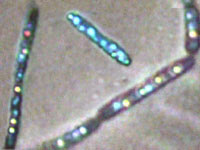 Tony's thoughts on the Natural World: 13c. Bacteria and other ...