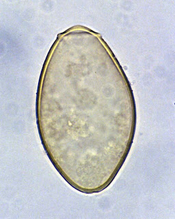 Adirondack Musing ™: Parasitic Worms - Trematode Infections