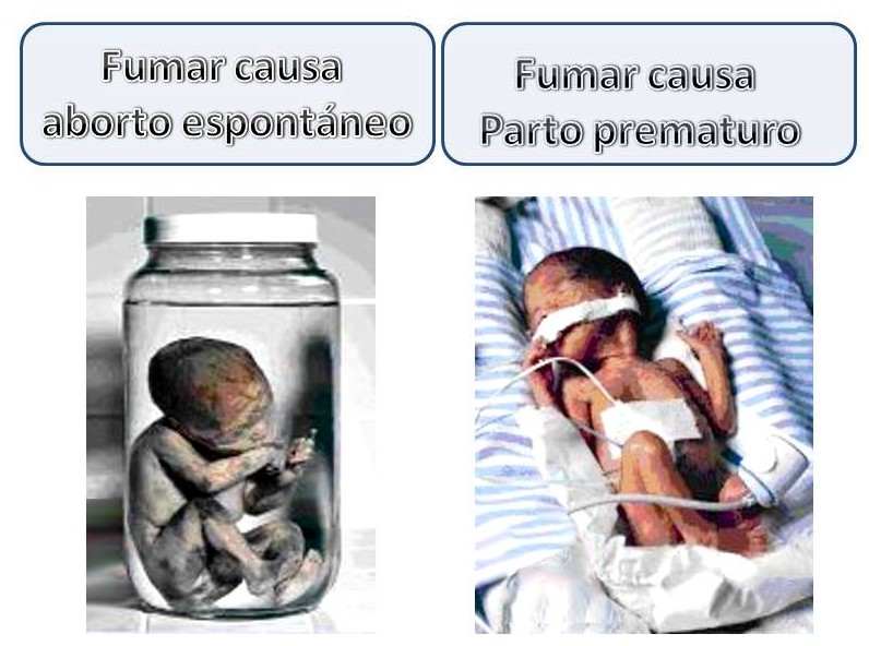 Fumar en el embarazo