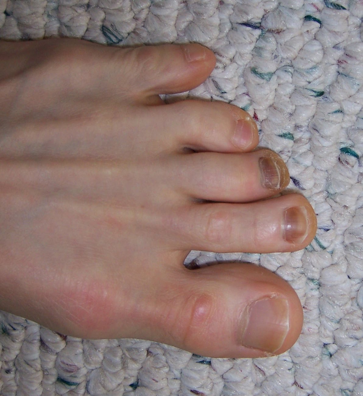 The Resurrected Runner: April 2010