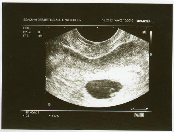 Jessica's Baby Blog!: Ultrasound pictures Week 6-12!!!