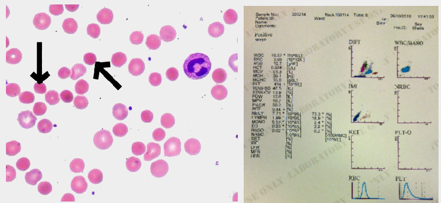 A Dull Day At Work...?: October 7 2010 (Thursday) - Hereditary ...