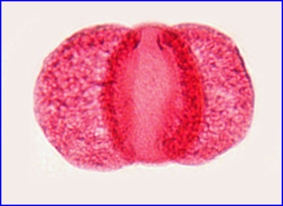 Colorado Earth Science: Fossil Pollen Reveals Florissant's Ice Age ...