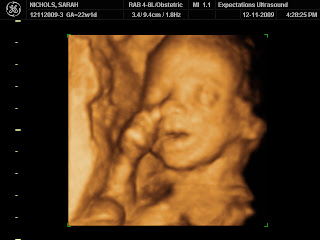 The Nichols Family: 3d/4d Ultrasound 22 Weeks!