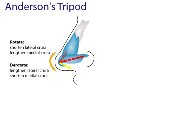 Shield Graft: The Nose Tip: Dimensional Analysis 101