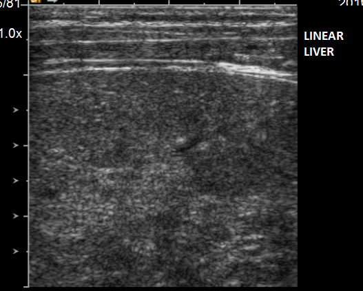 Montgomery College - Diagnostic Medical Sonography: Week 10 Case Study ...