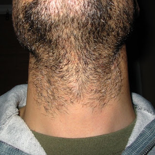 muiseam: The Hairiest Neck