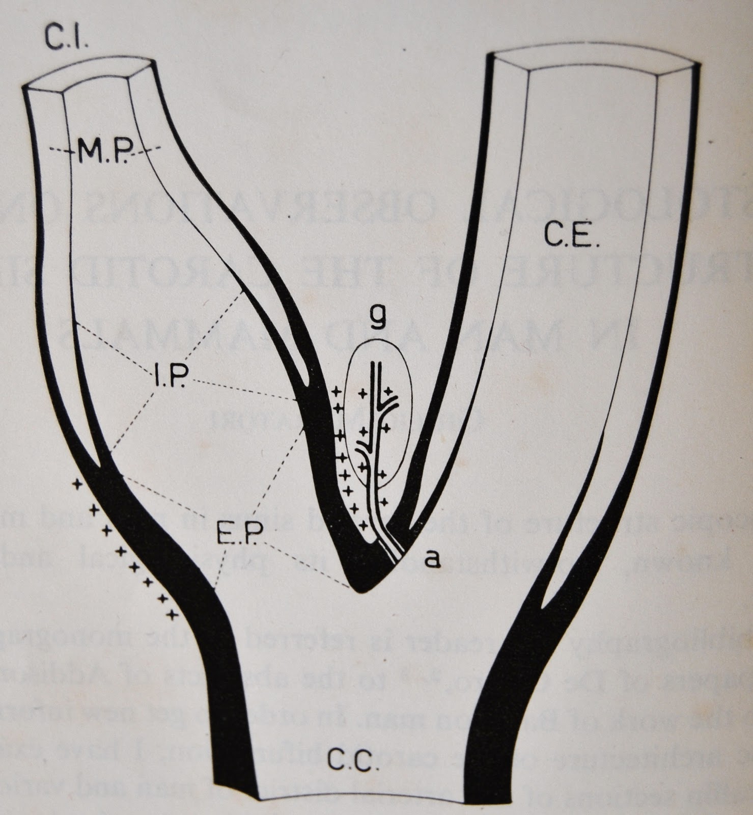 HISTOPATOLOGIA FORENSE PRACTICA (FORENSIC PATHOLOGY FORUM): 6.-SIGNS IN ...