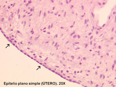 Lab Histo Odonto: Epitelio Plano Simple