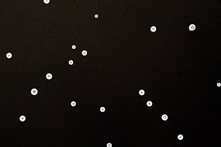 Clinical Microbiology Photoblog: Cryptococcus neoformans: Negative Staining