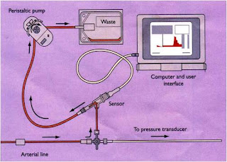 Anaesthesiology at Narayana Hrudayalaya