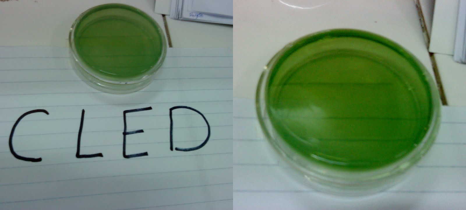 c.E.r.i.T.e.T.e.N.t.A.n.G.k.i.T.e.: Culture Media...