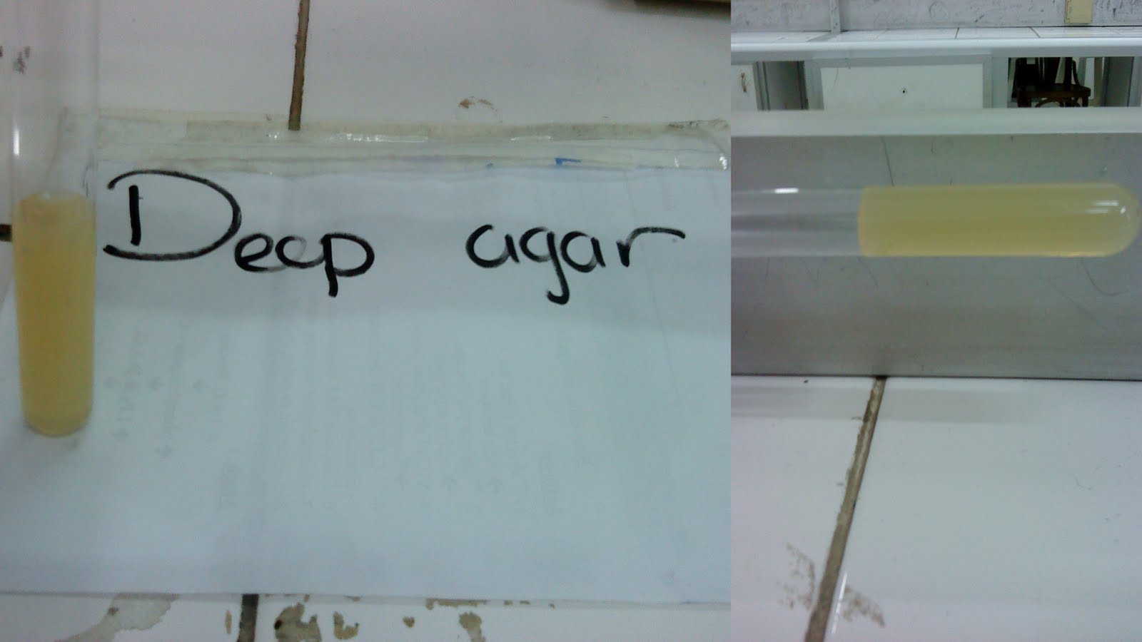 c.E.r.i.T.e.T.e.N.t.A.n.G.k.i.T.e.: Culture Media...