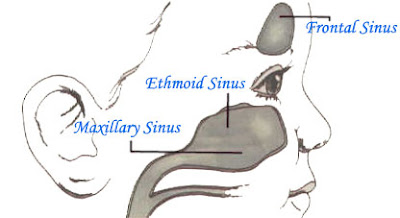 Your Health Guru: What is Sinusitis?
