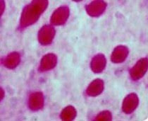 albuminas y globulinas